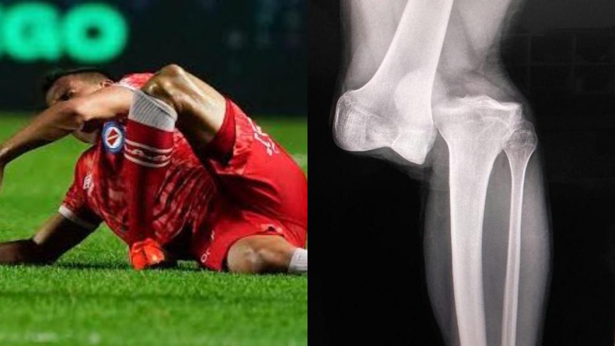 Luciano Sánchez habla del pisotón de Marcelo por primera vez