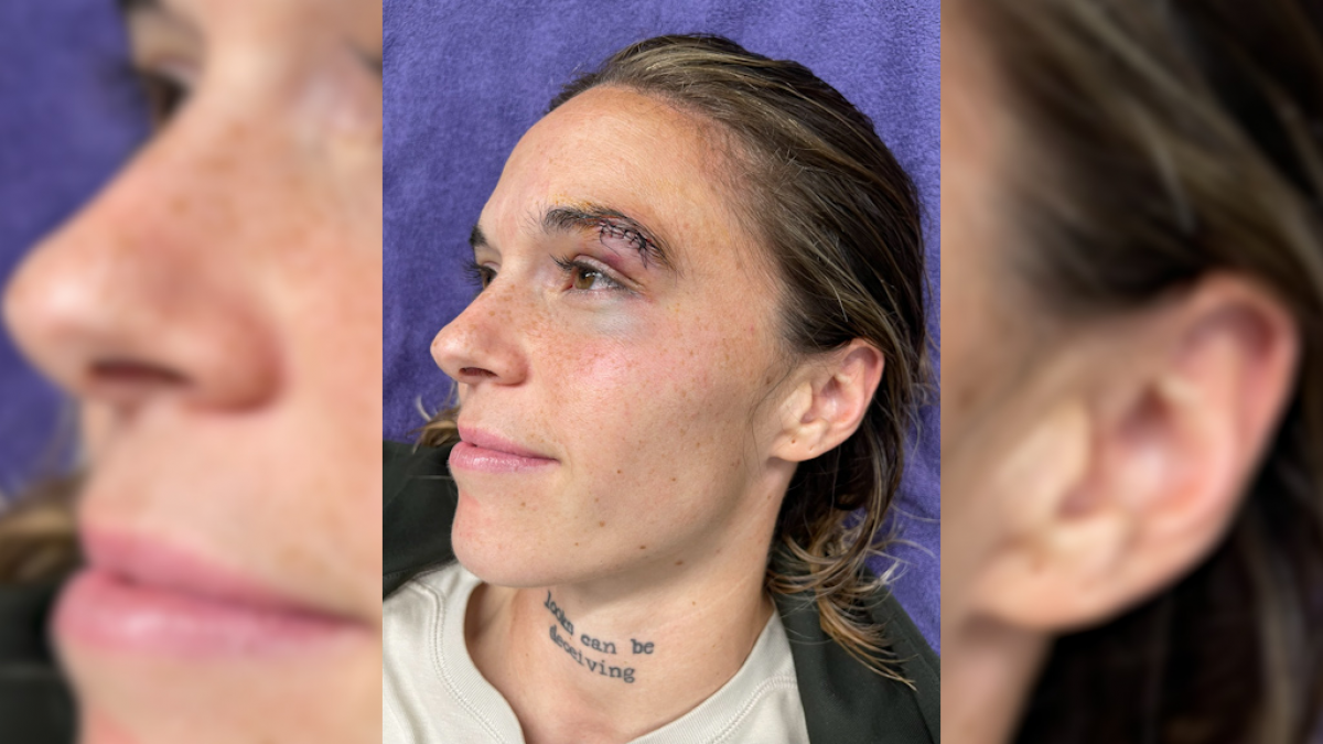 Mapi León pide a la Liga F que implemente el VAR