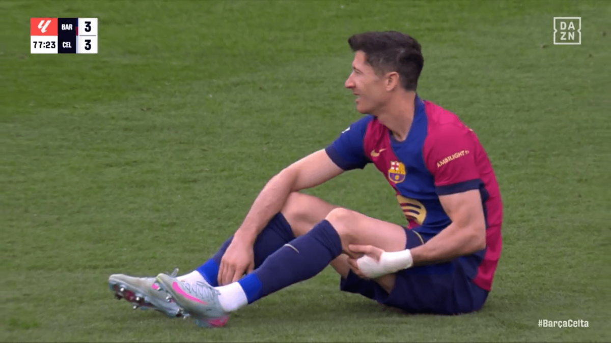 FC Barcelona: Lesión de Robert Lewandowski, qué tiene y tiempo de baja